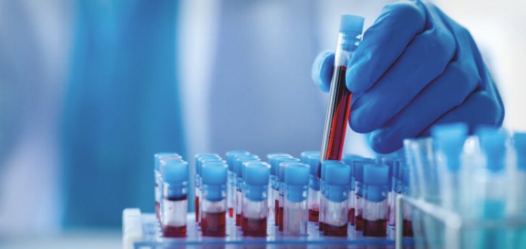 University of Tokyo Unveils Powerful AI Blood Test